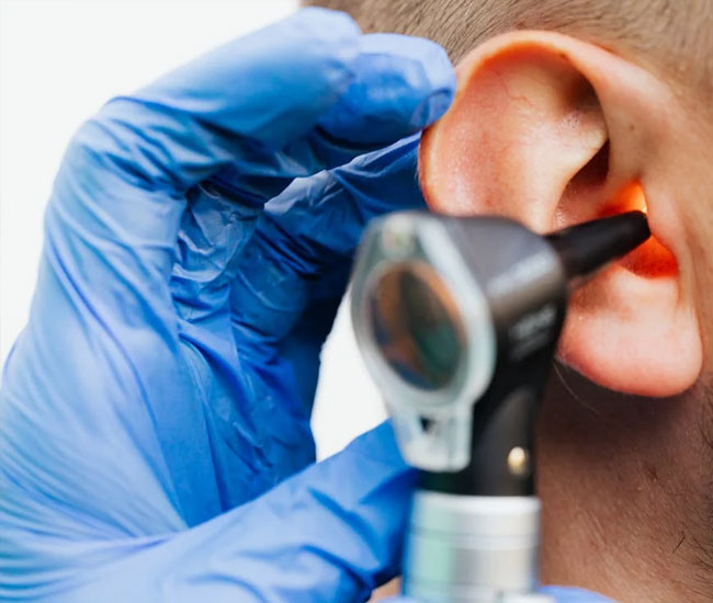 Mobile Ear Wax Removal Specialists Serving Guildford - Mobile Ear Wax ...